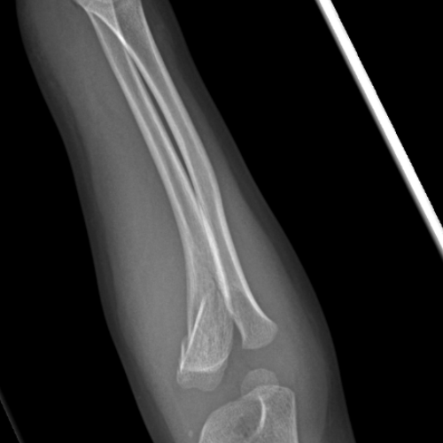 Case #11 - CaseStacks.com