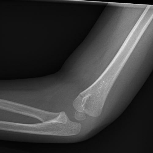 Case #12 - CaseStacks.com