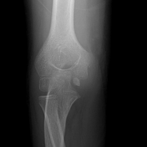 Case #20 - CaseStacks.com