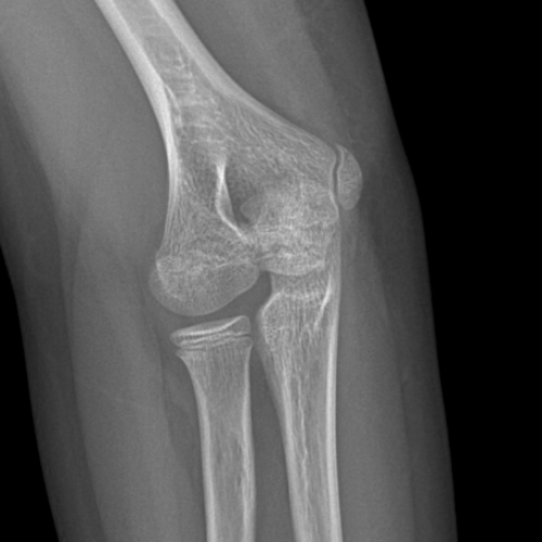 Case #21 - CaseStacks.com