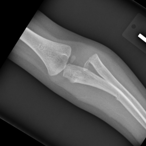 Case #26 - CaseStacks.com