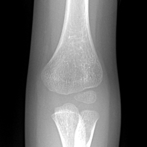 Case #28 - CaseStacks.com