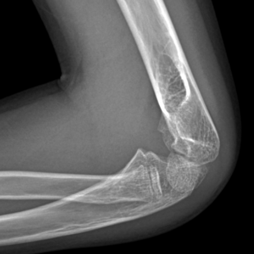 CaseStacks.com - Radiology Case Case #37