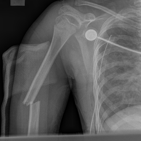 Case #11 - CaseStacks.com