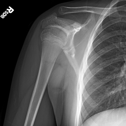 Case #12 - CaseStacks.com