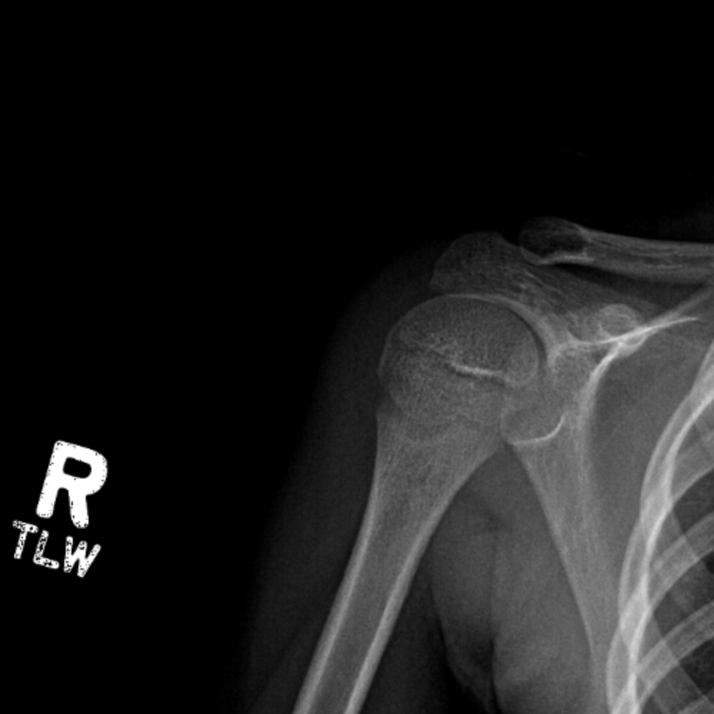 Case #1 - CaseStacks.com