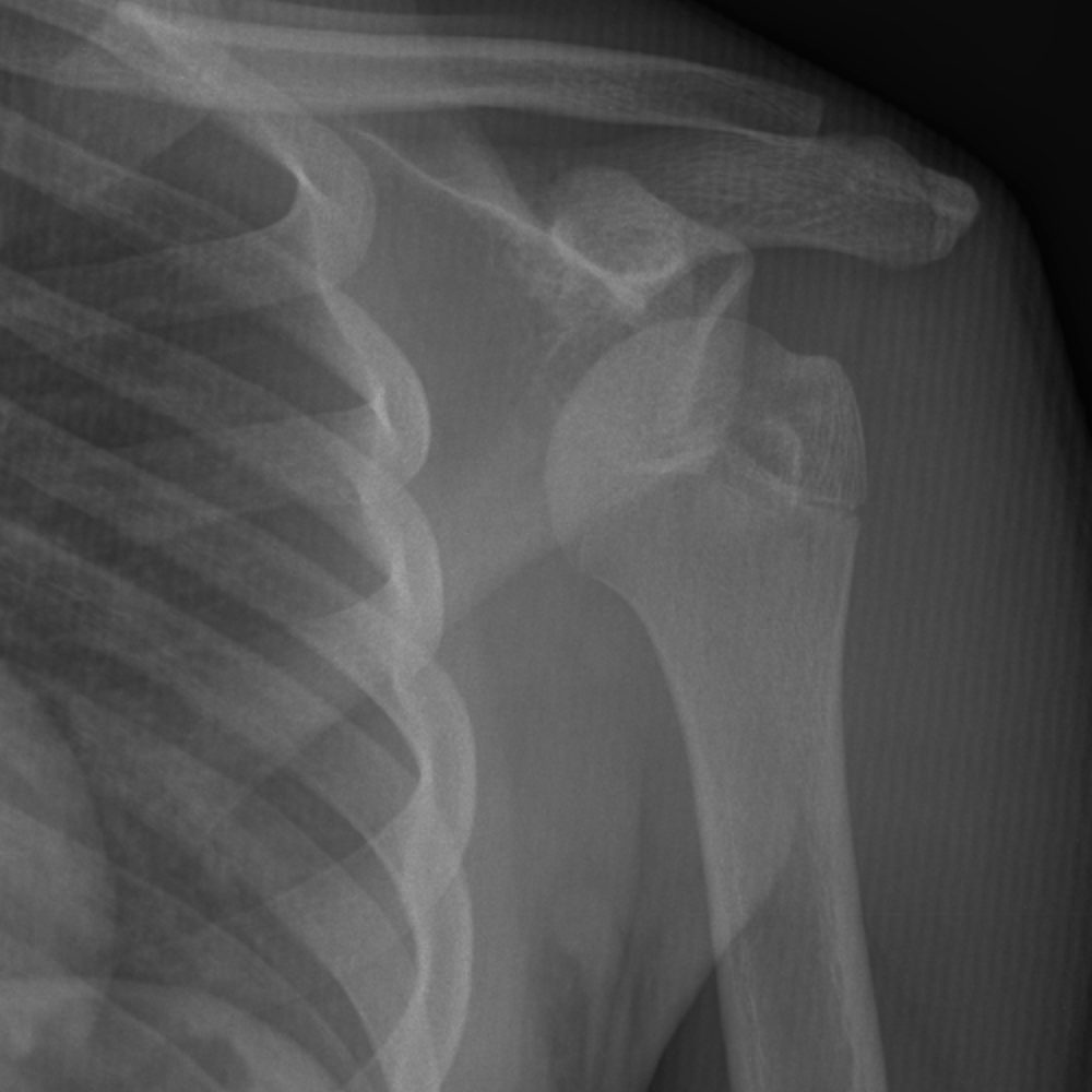 Case #3 - CaseStacks.com