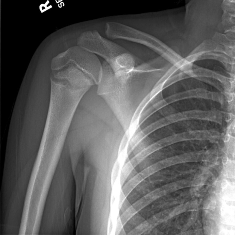 Case #6 - CaseStacks.com