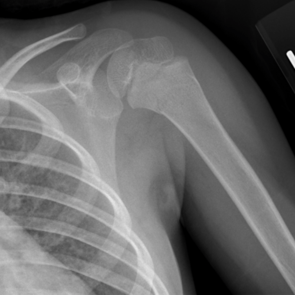 Case #9 - CaseStacks.com