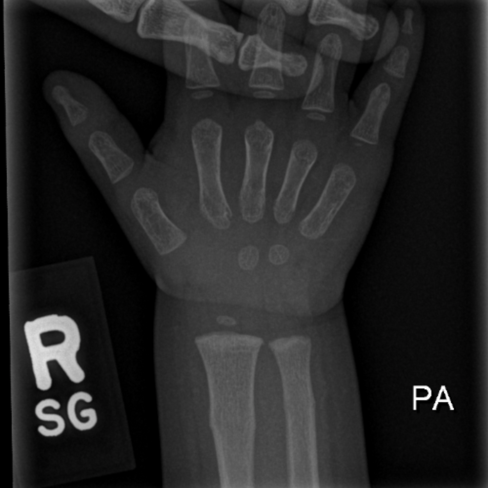 Case #1 - CaseStacks.com