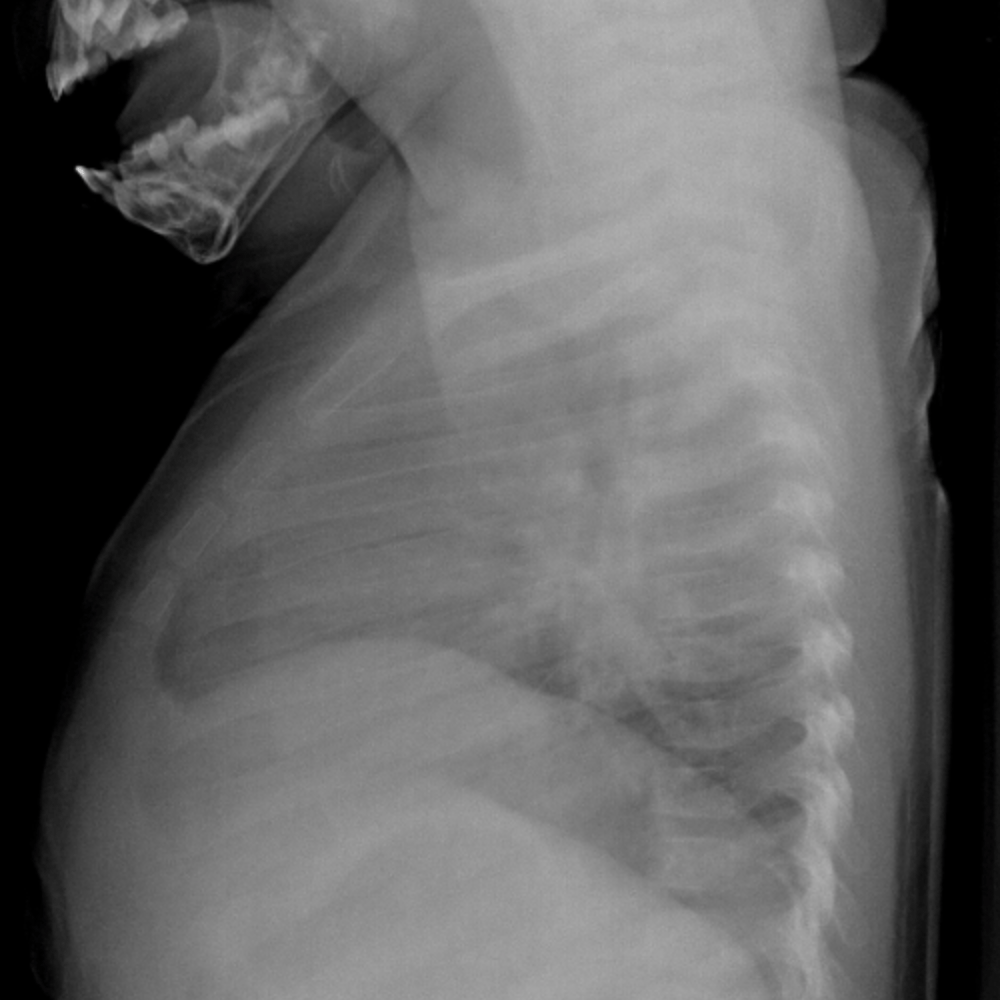 Case #1 - CaseStacks.com