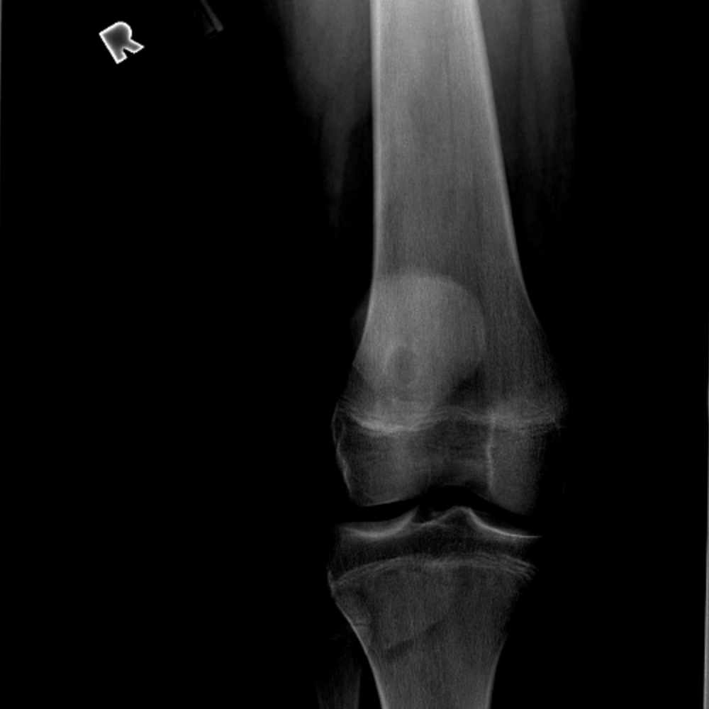 Case #1 - CaseStacks.com