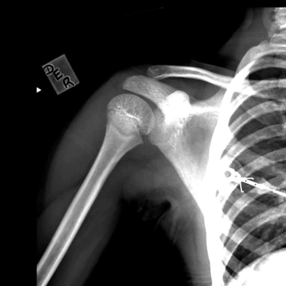 Case #10 - CaseStacks.com