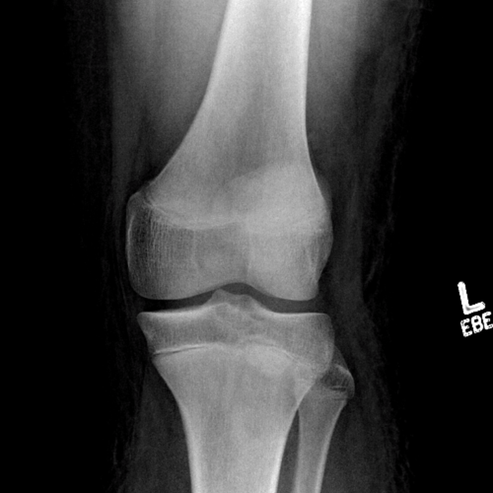 Case #11 - CaseStacks.com