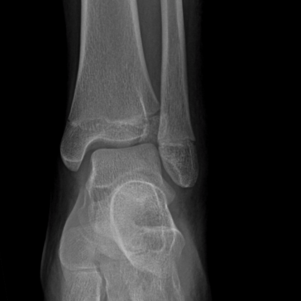 CaseStacks.com - Radiology Case Case #11