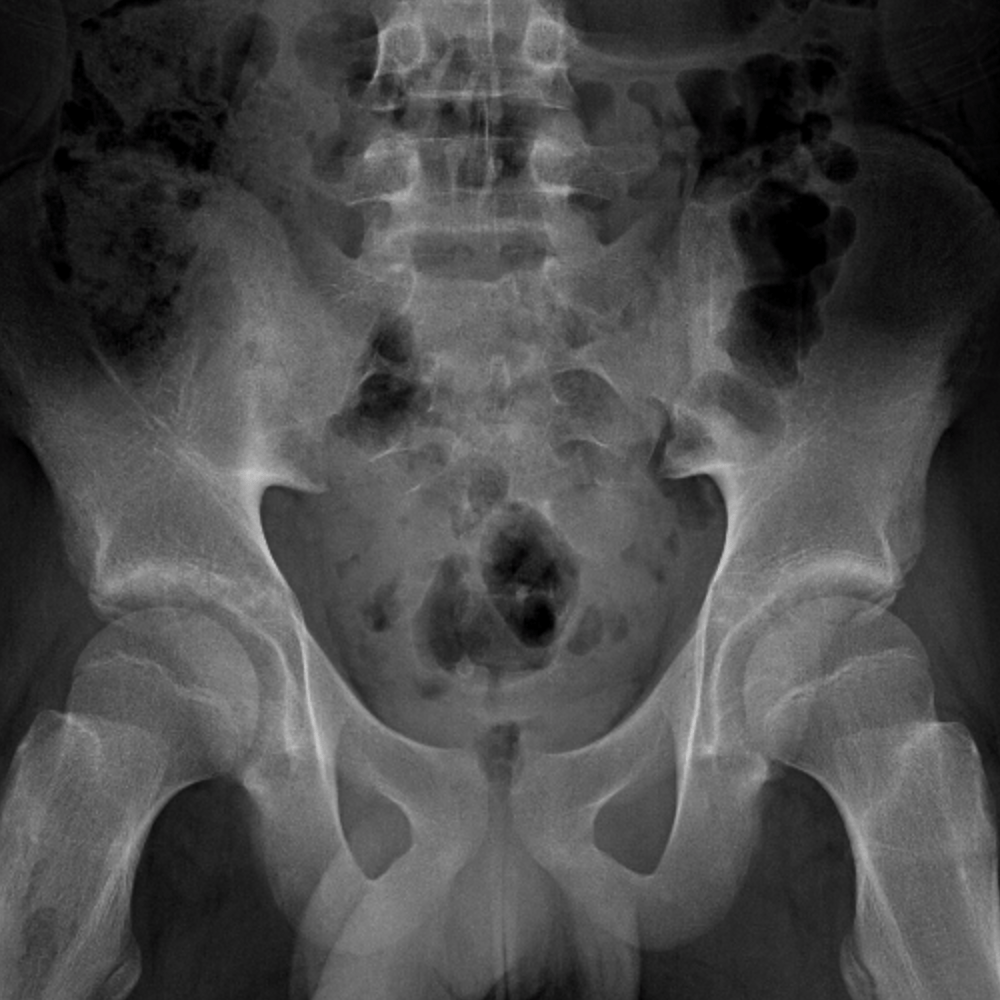 Case #11 - CaseStacks.com