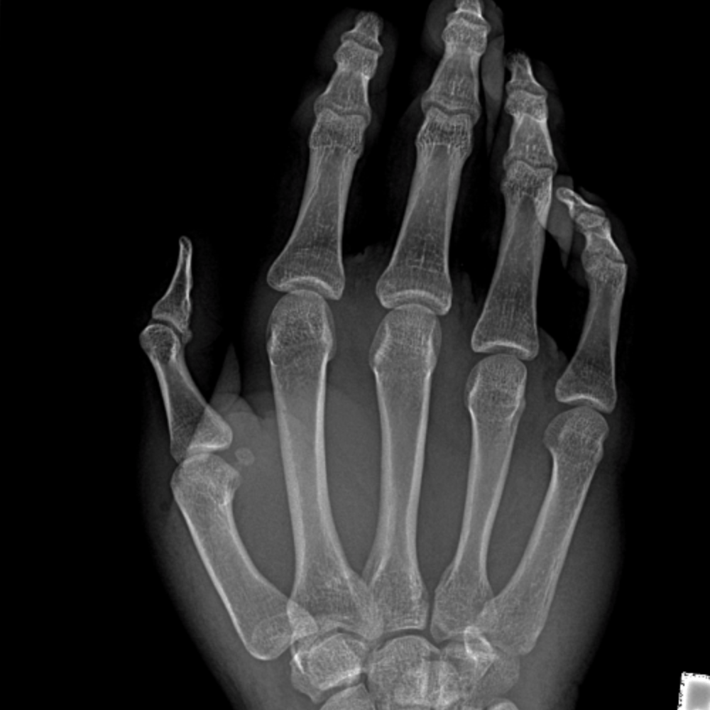 Case #11 - CaseStacks.com