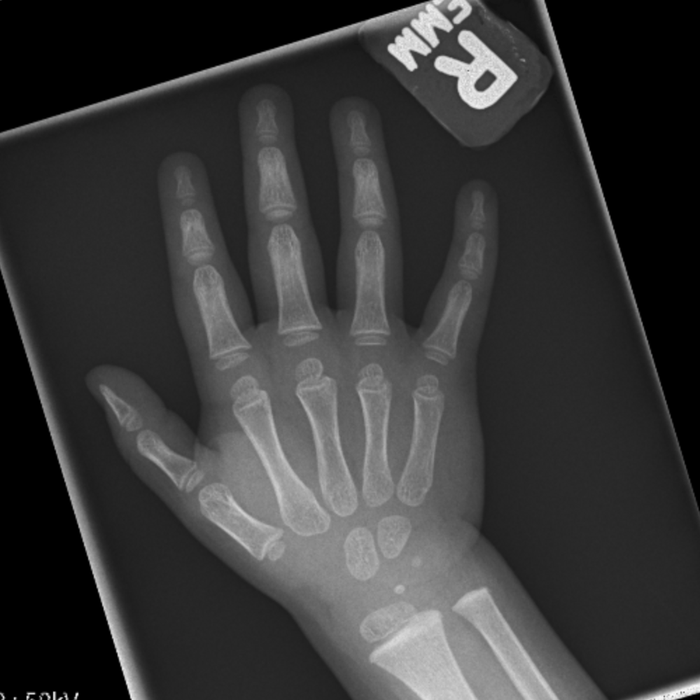 Case #12 - CaseStacks.com