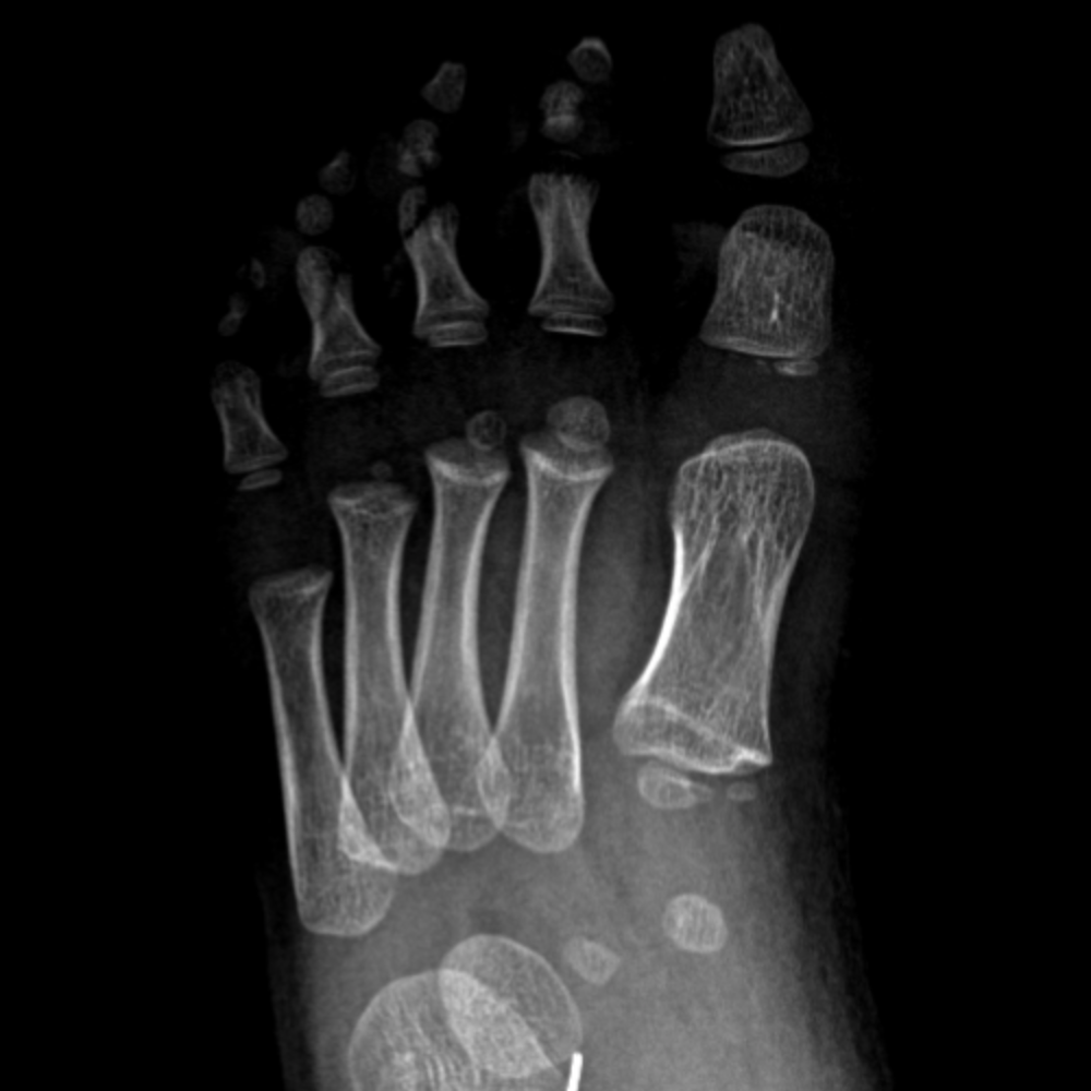 Case #13 - CaseStacks.com