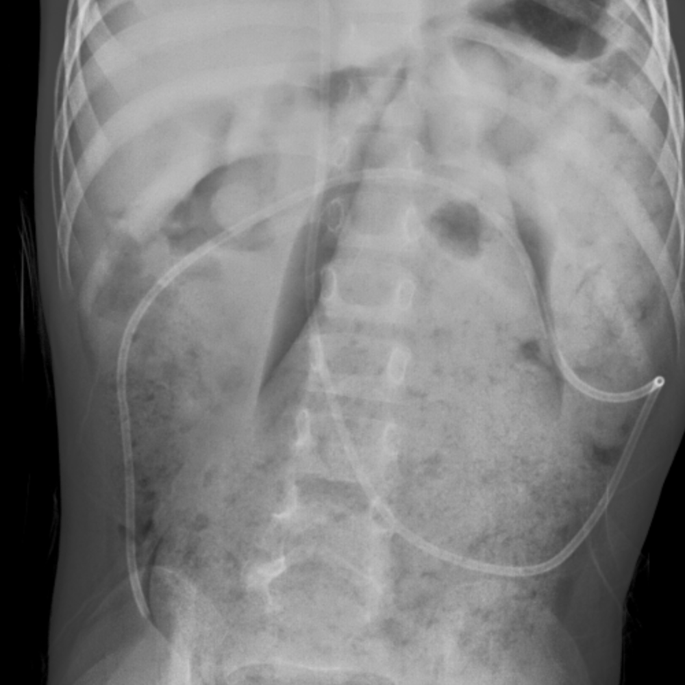 Case #13 - CaseStacks.com