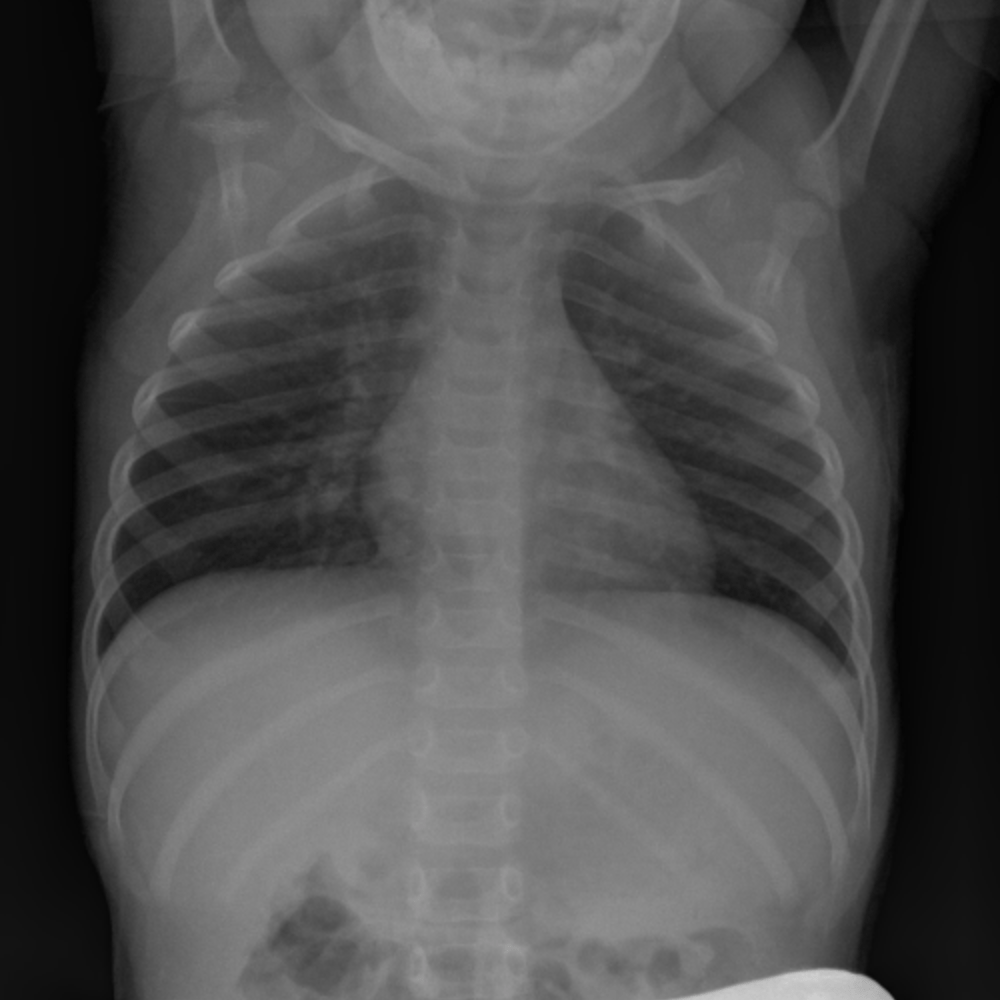 Case #13 - CaseStacks.com