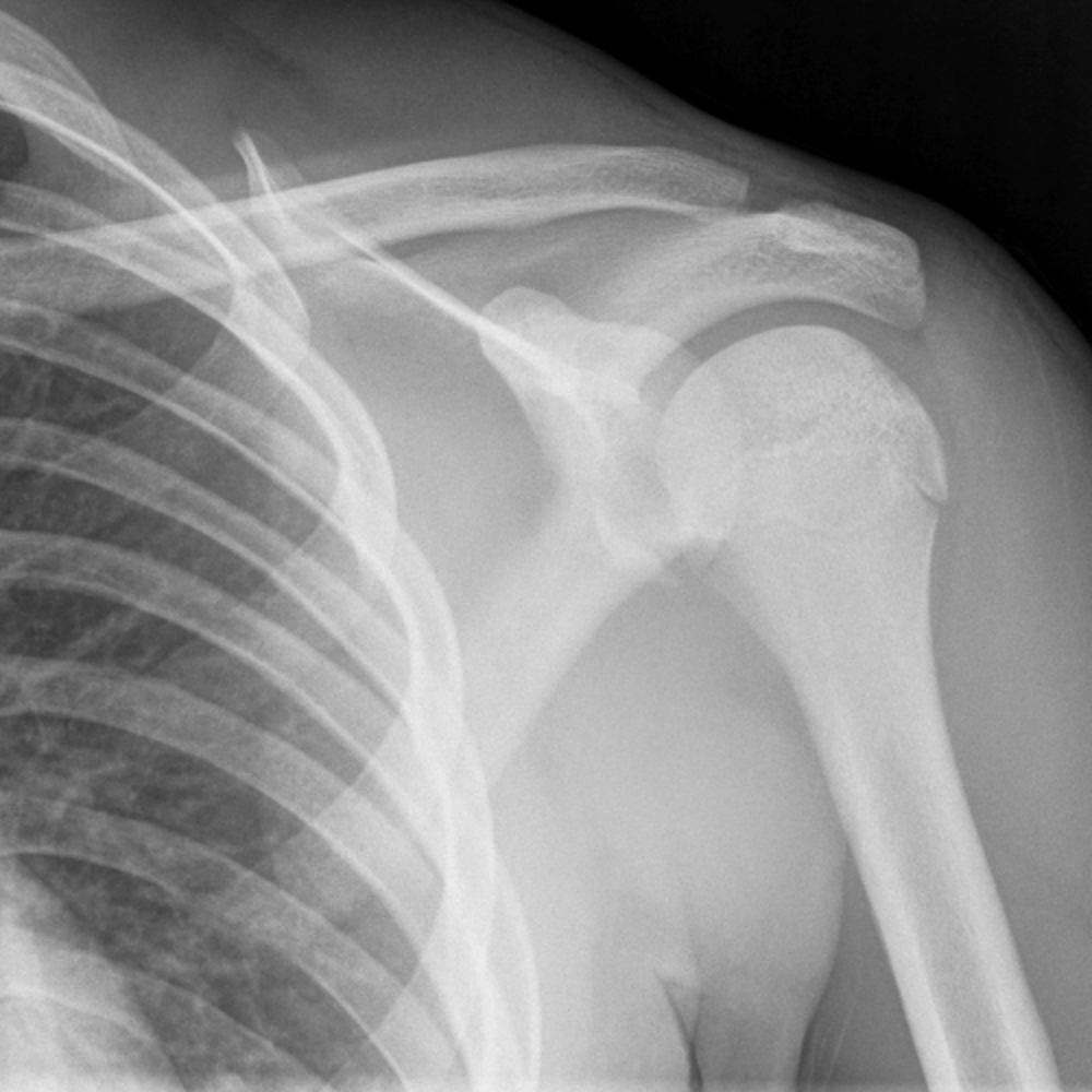 Case #13 - CaseStacks.com