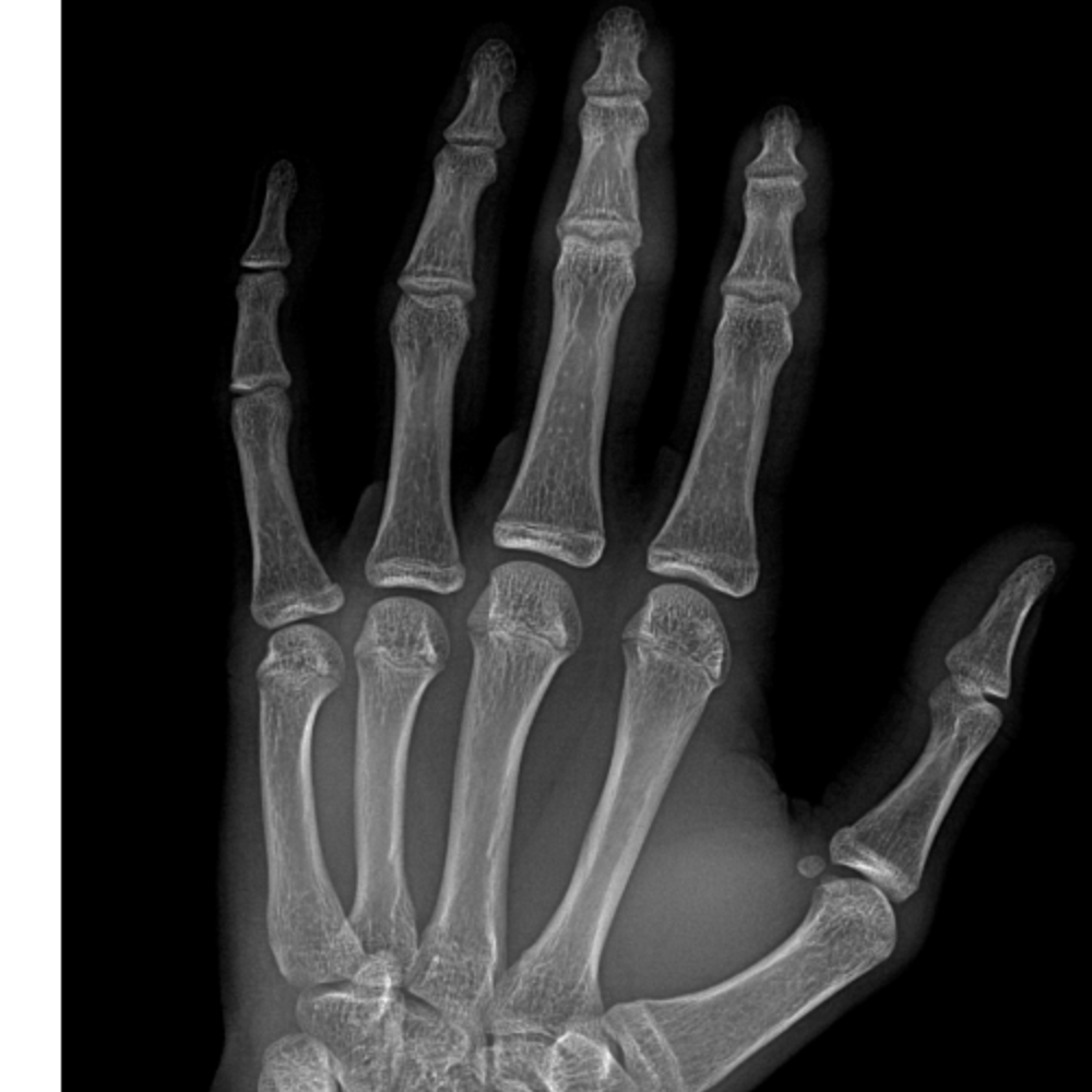 Case #14 - CaseStacks.com