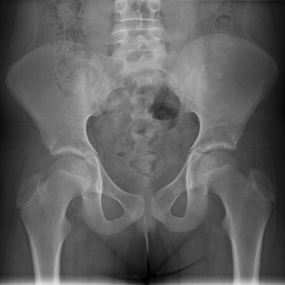 Case #14 - CaseStacks.com