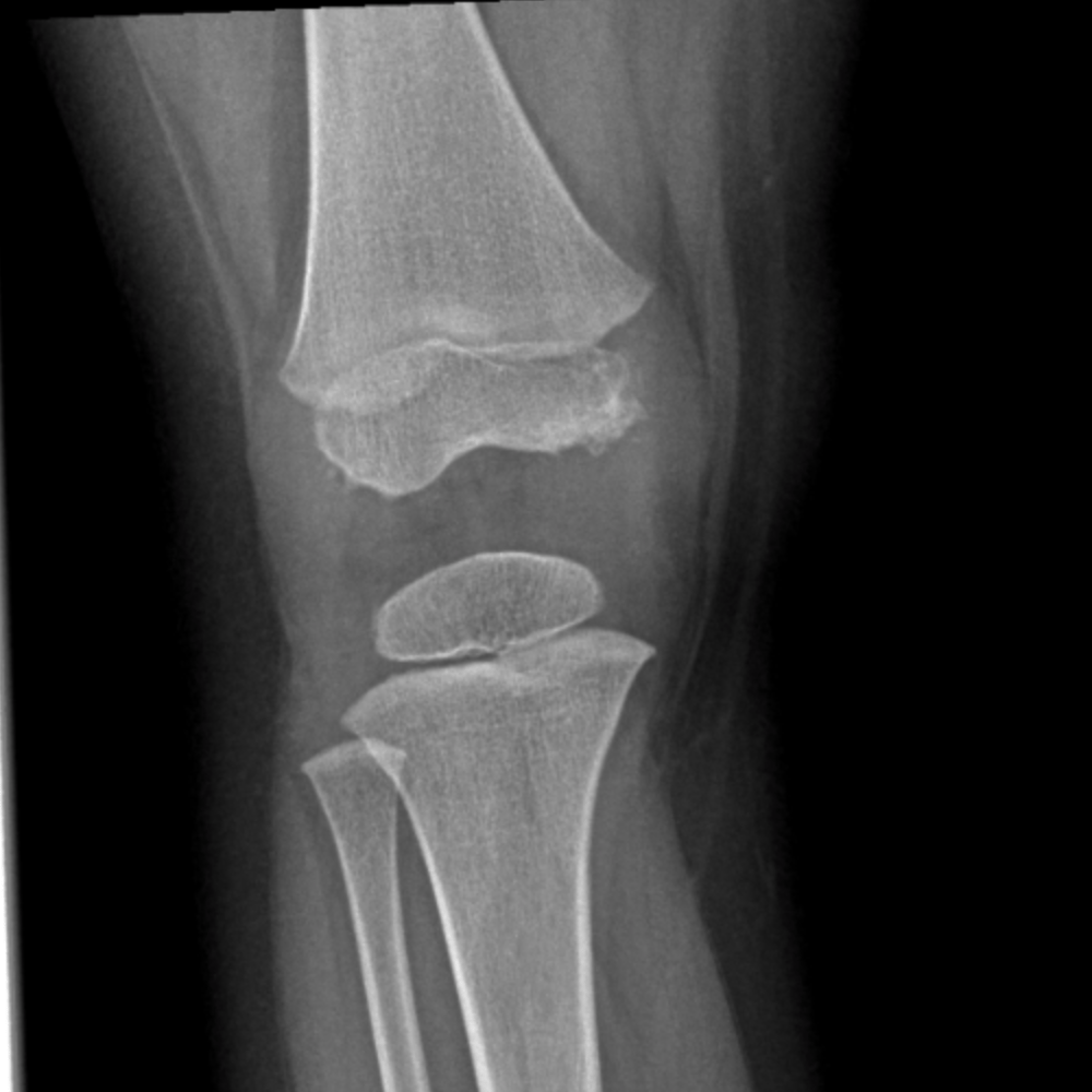 Case #14 - CaseStacks.com