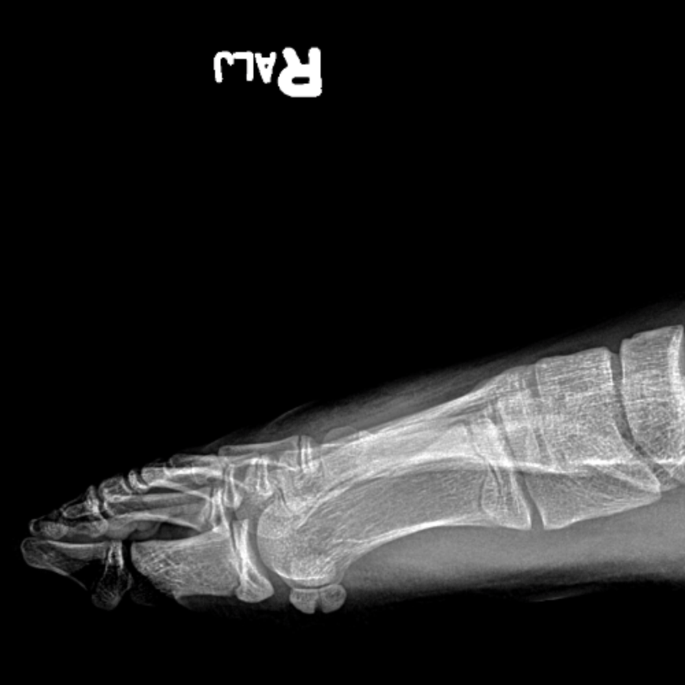 CaseStacks.com - Peds Radiographs Case #14