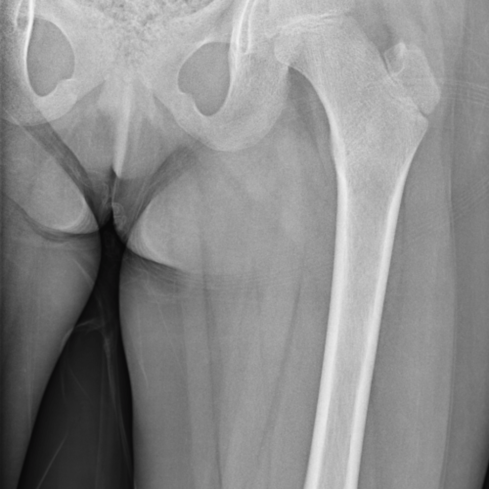 CaseStacks.com - Radiology Case Case #14