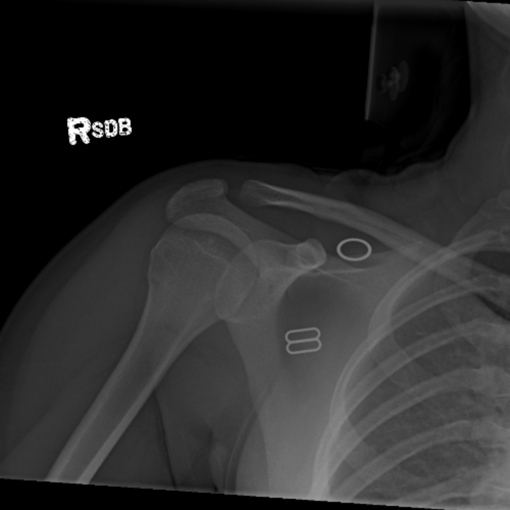 Case #14 - CaseStacks.com