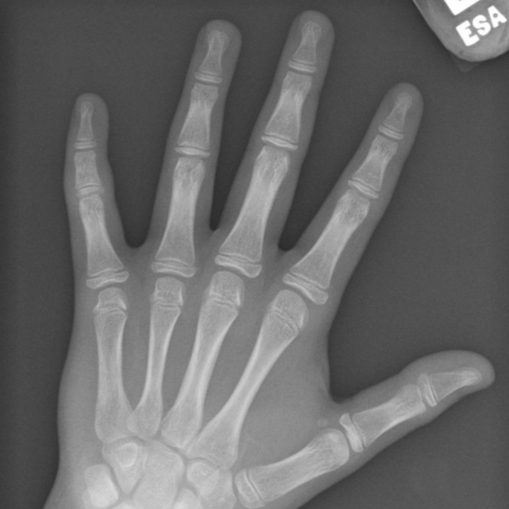 Case #15 - CaseStacks.com