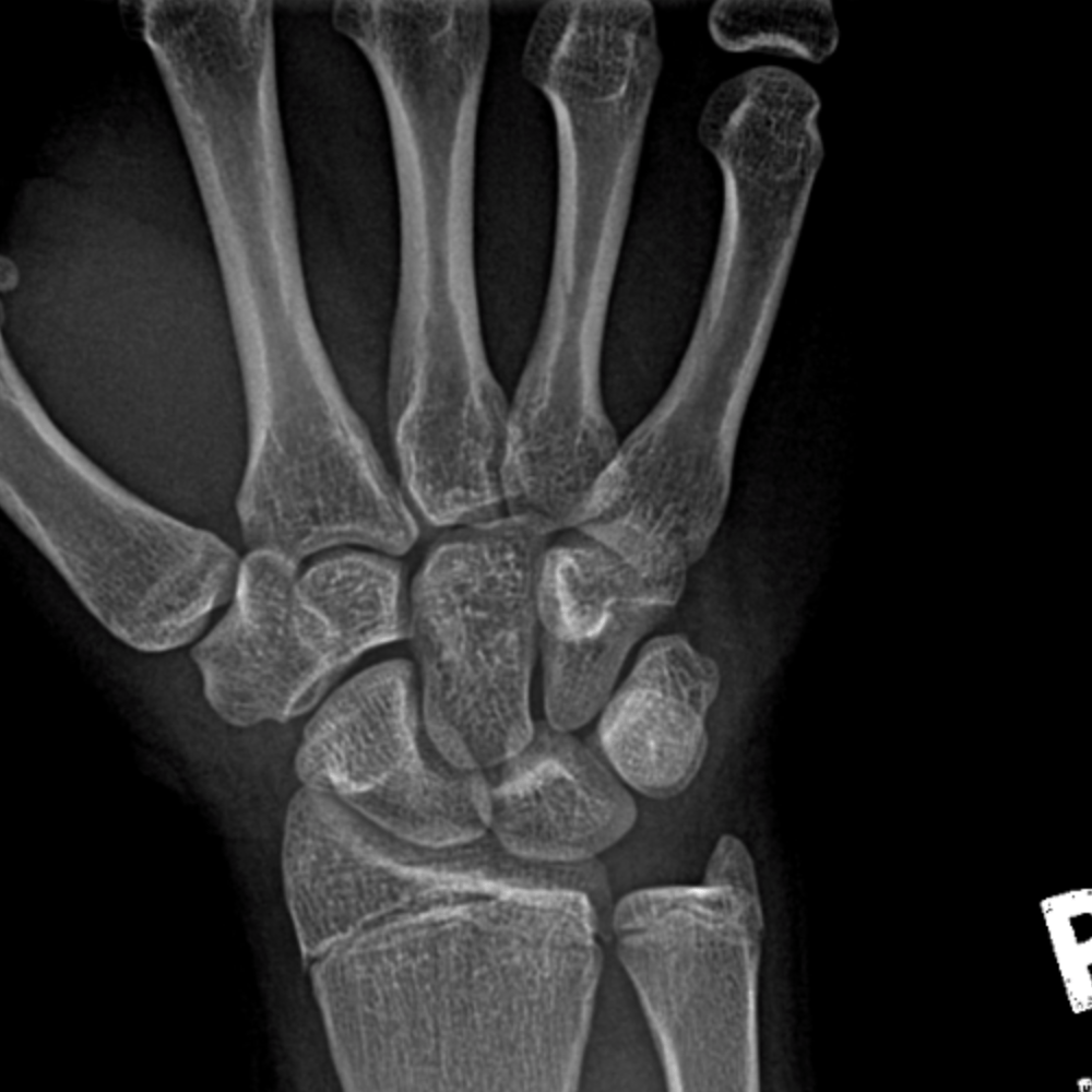 CaseStacks.com - Radiology Case Case #19