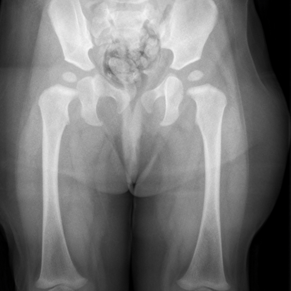 Case #19 - CaseStacks.com