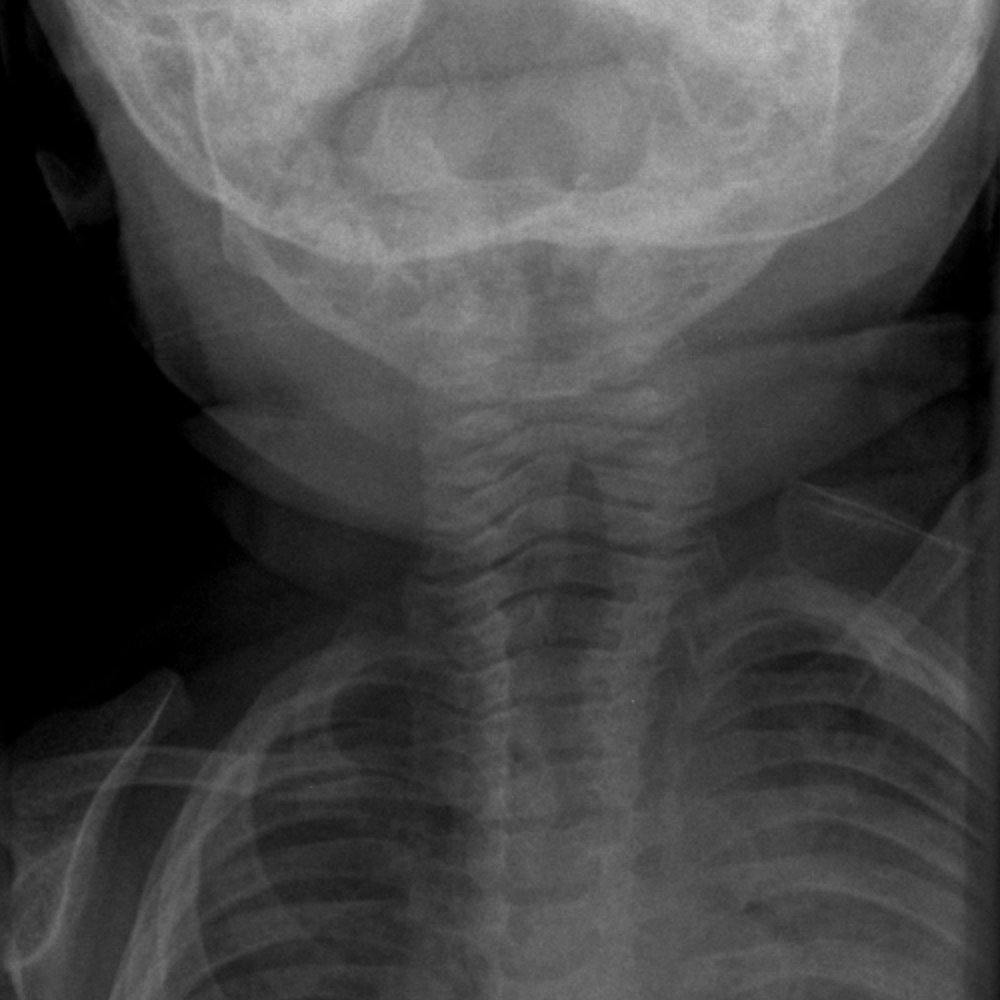 Case #19 - CaseStacks.com