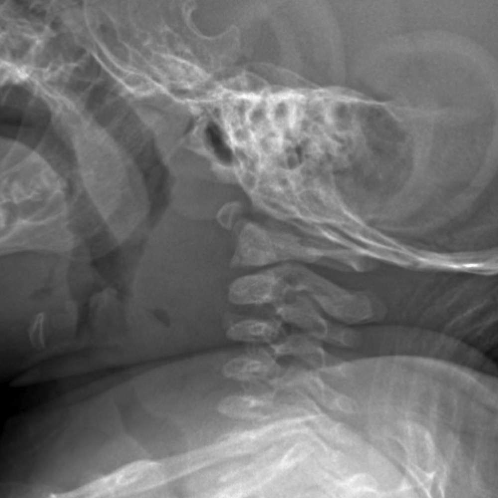 Case #2 - CaseStacks.com