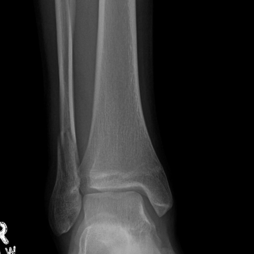 Case #2 - CaseStacks.com