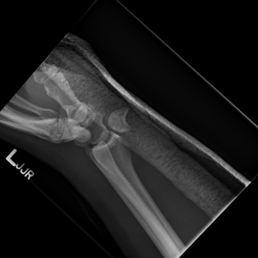 Case #20 - CaseStacks.com