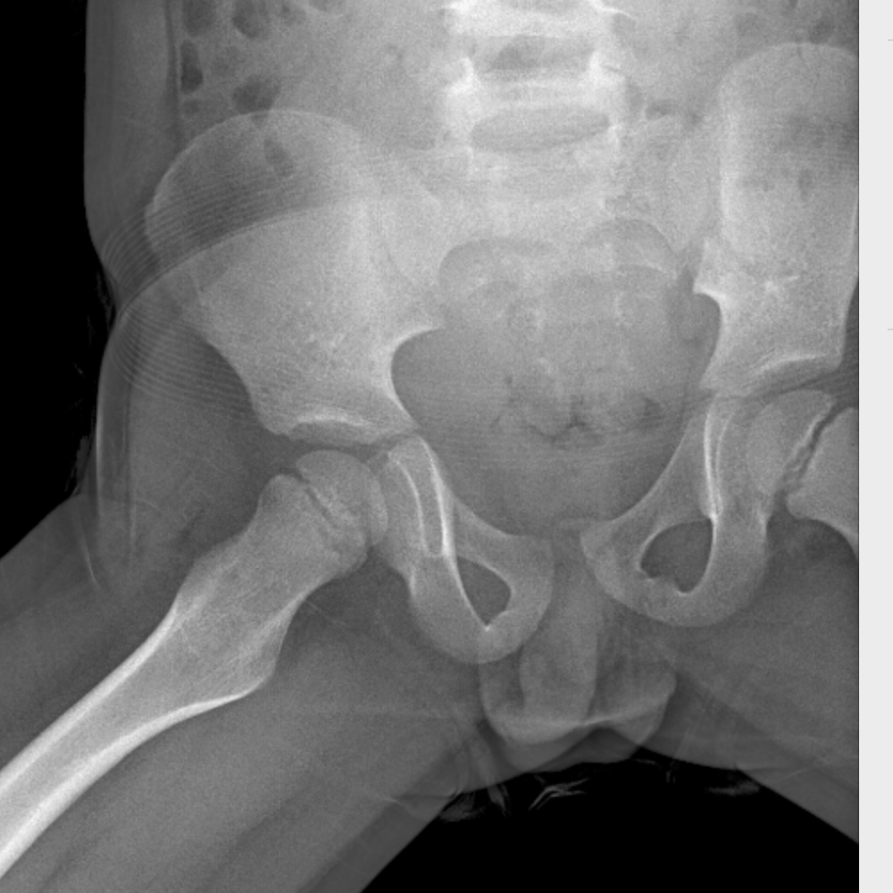 Case #20 - CaseStacks.com