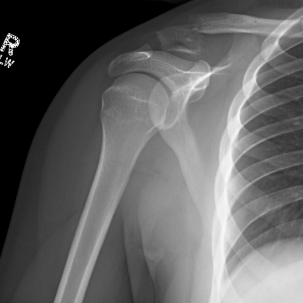 Case #20 - CaseStacks.com