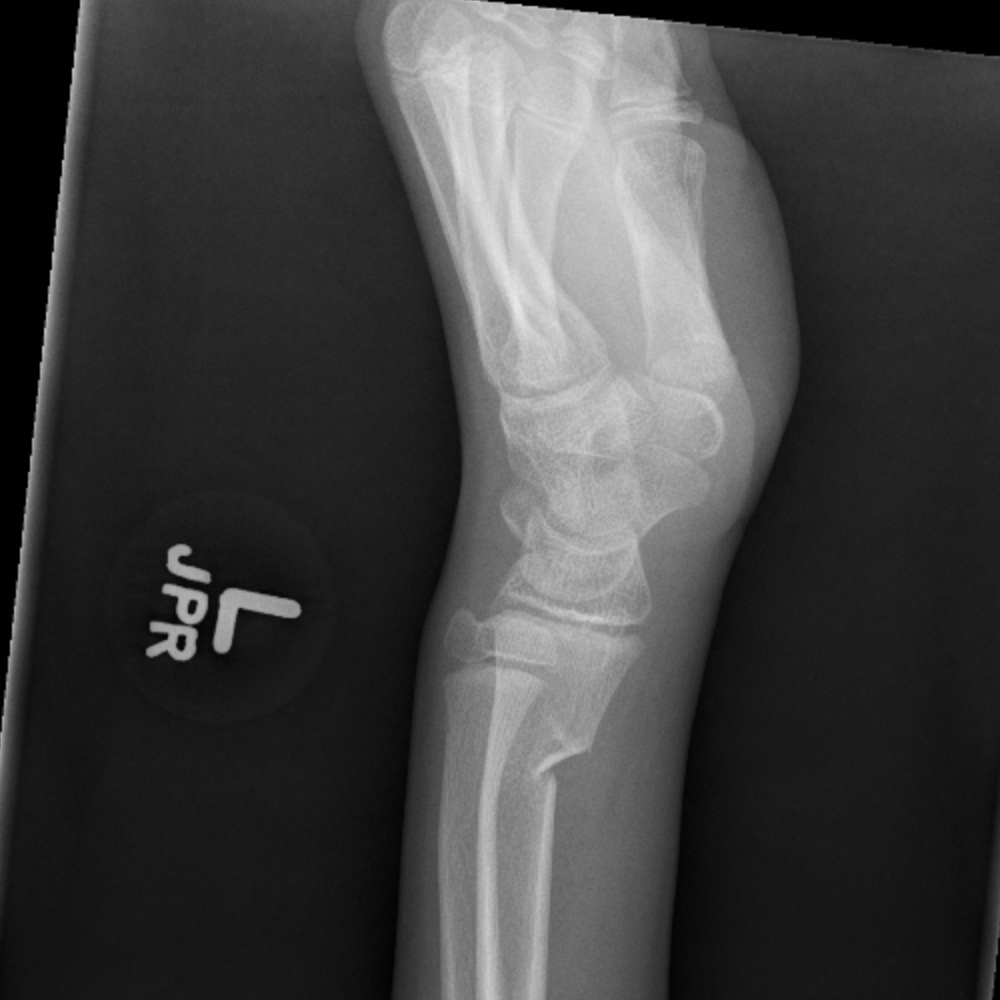 Case #21 - CaseStacks.com