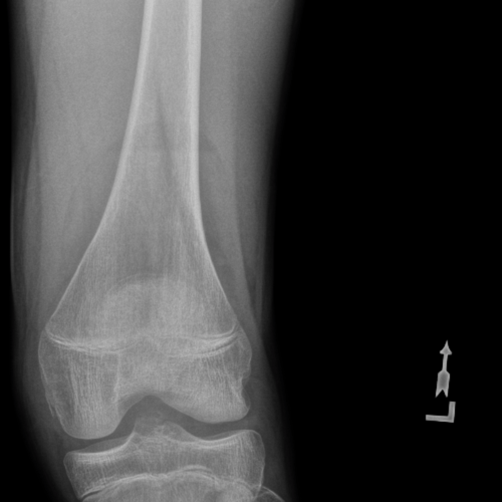 Case #21 - CaseStacks.com