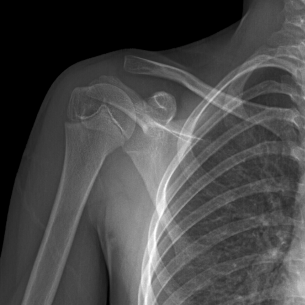 Case #21 - CaseStacks.com