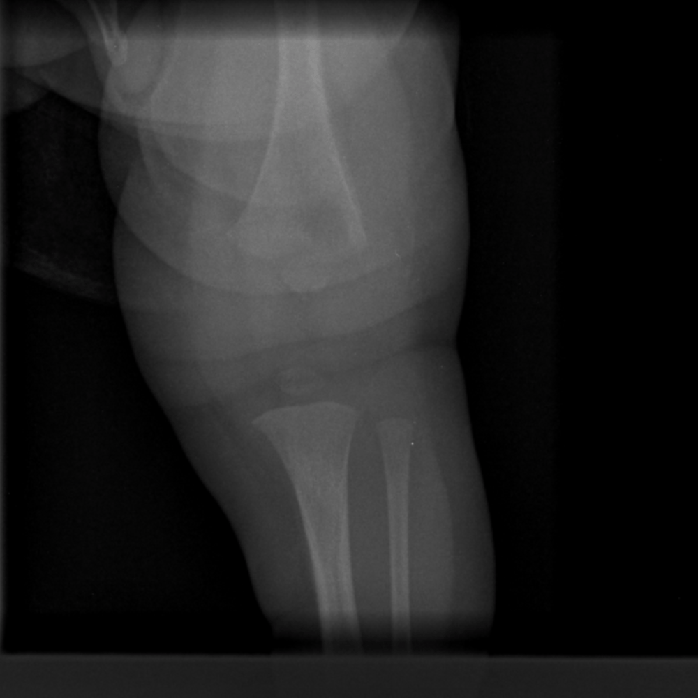 Case #23 - CaseStacks.com