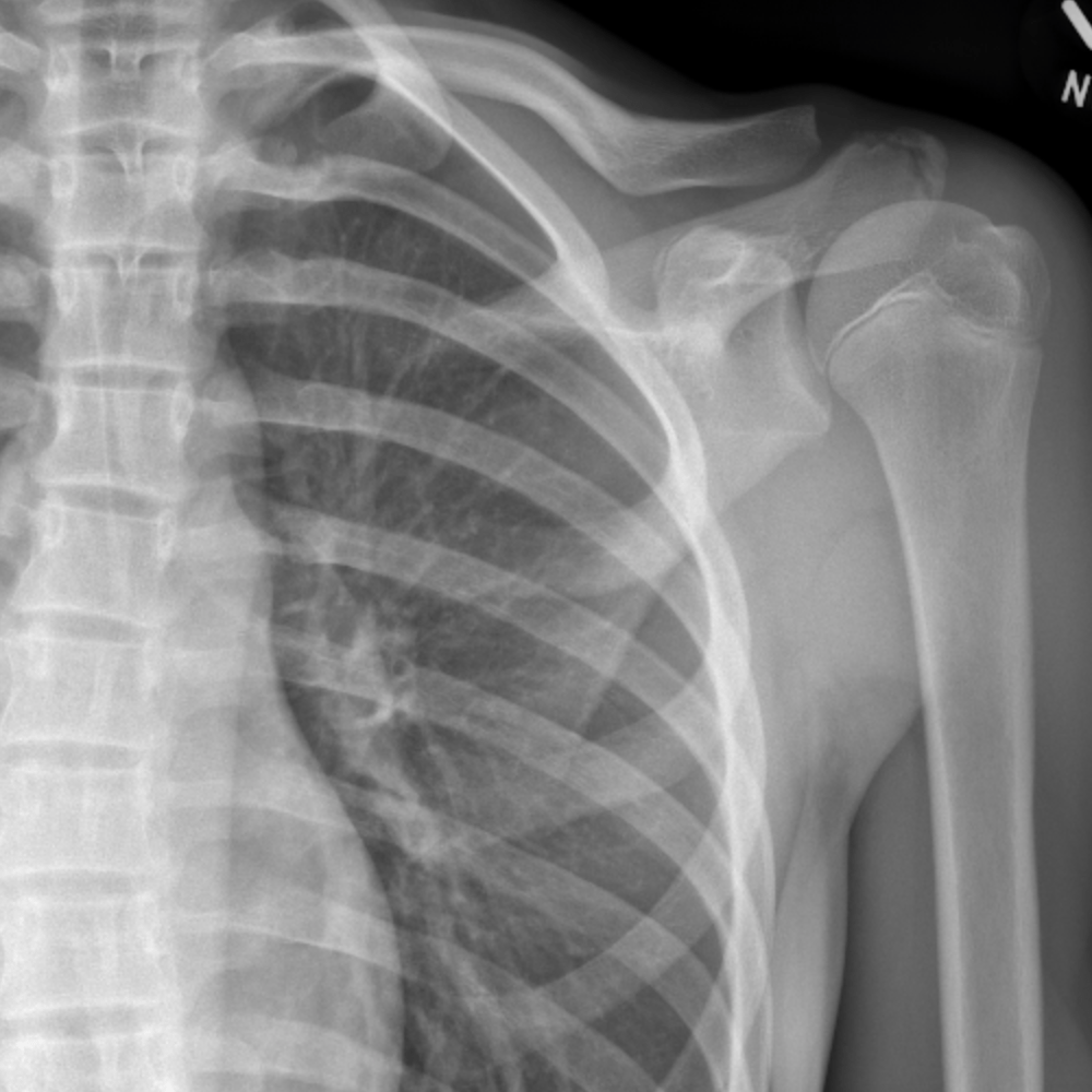 CaseStacks.com - Radiology Case Case #25