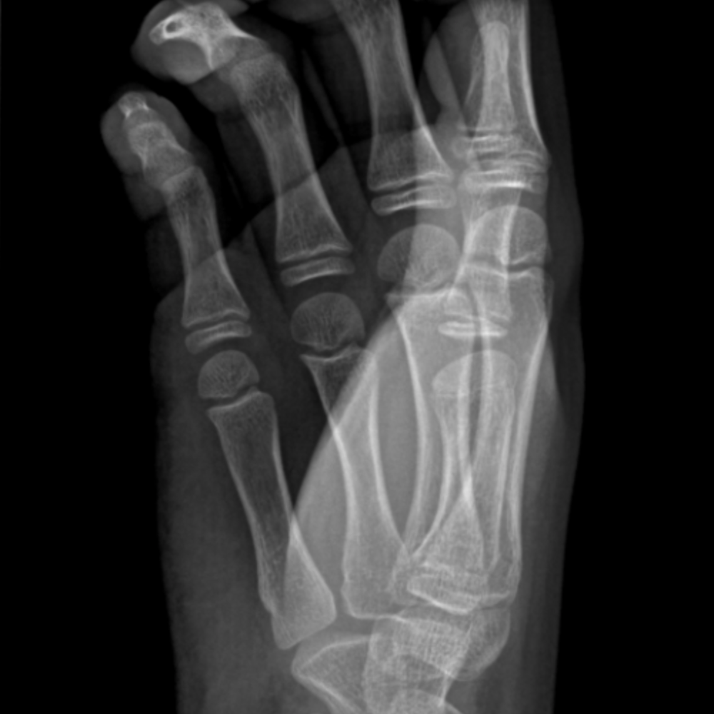 Case #26 - CaseStacks.com