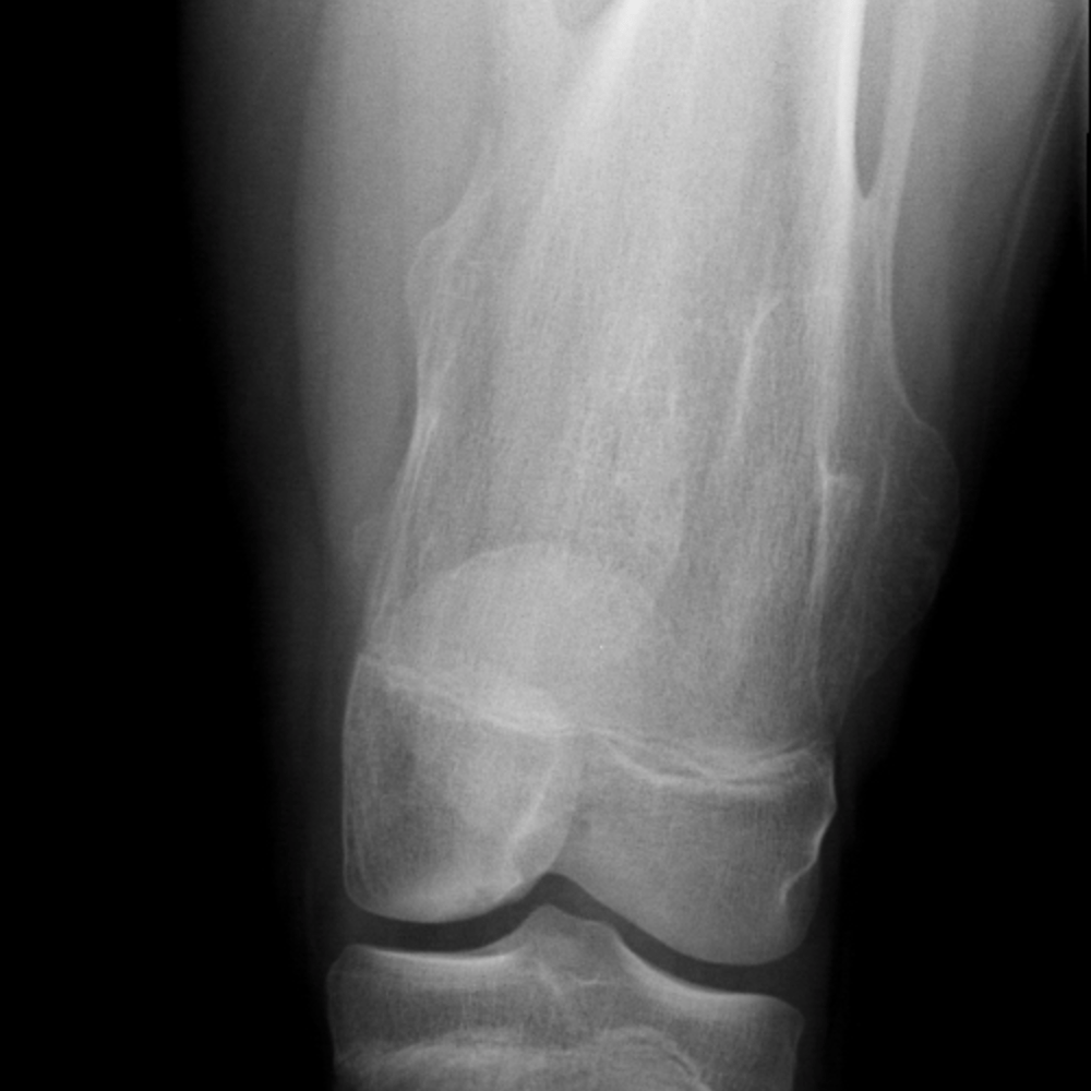 Case #26 - CaseStacks.com