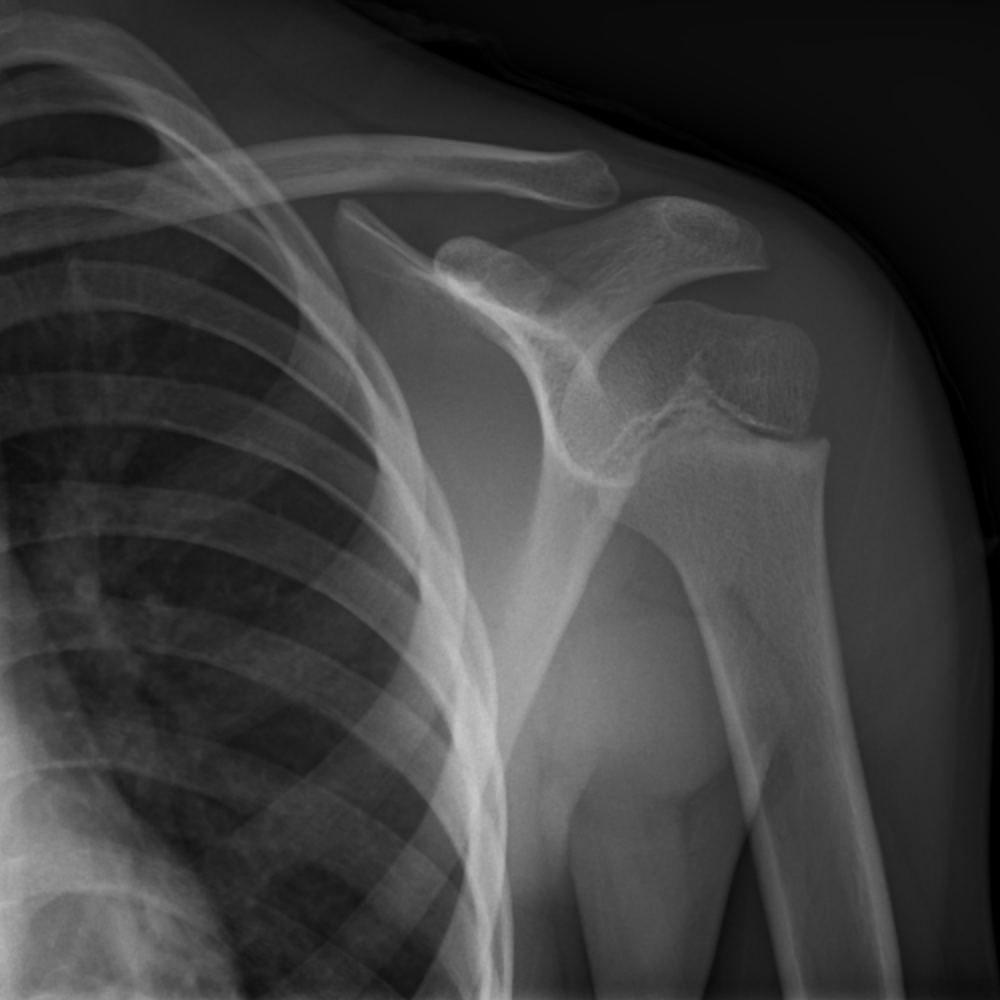 Case #26 - CaseStacks.com