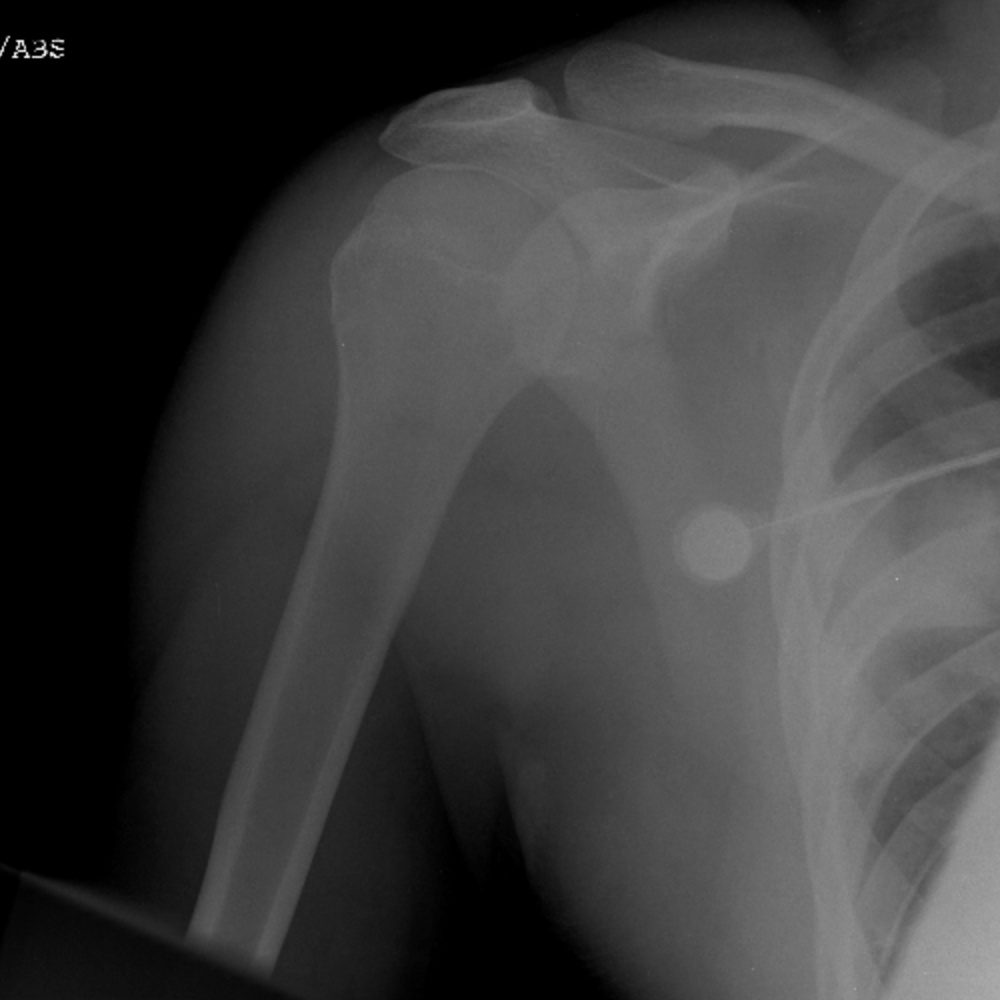 Case #28 - CaseStacks.com